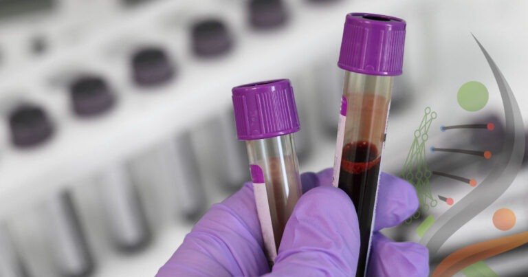 Medicare Blood Tests Century Medicare medicare-blood-tests-century-medicare